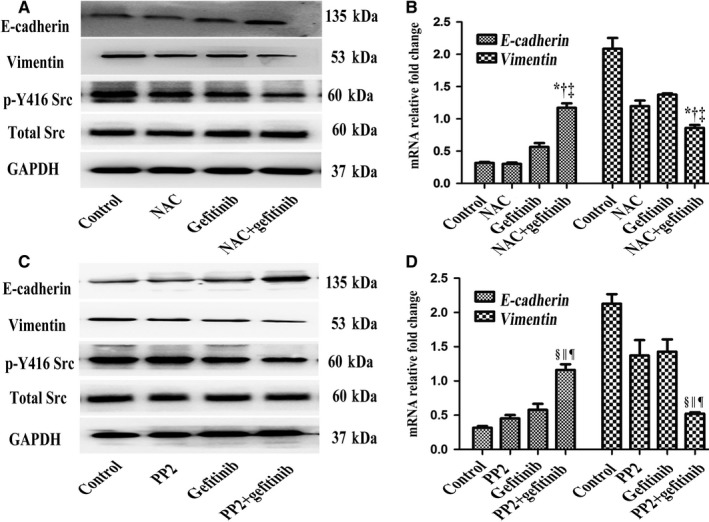 TargetMol明星分子——Gefitinib：EGFR 抑制剂